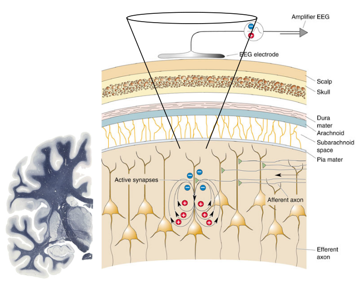 Periodic EEG features in light sleep and propofol sedation